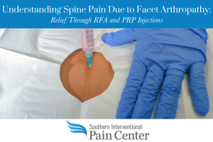Understanding Spine Pain Due to Facet Arthropathy: Relief Through RFA ...